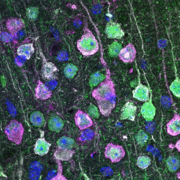 Cure Research Grants 2025 - FightMND